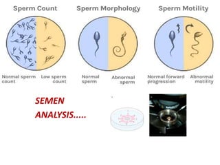 Sperm anatomy and physiology | PPTX