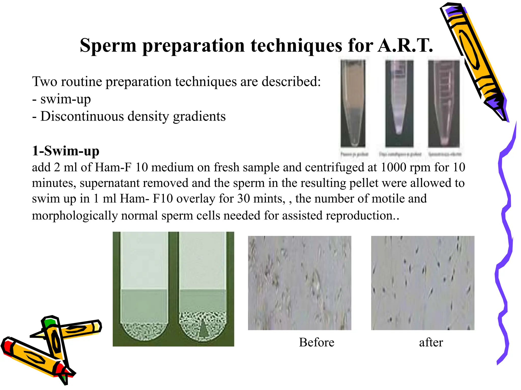 Sperm Assesmen&preparation&cryopreservation.ppt