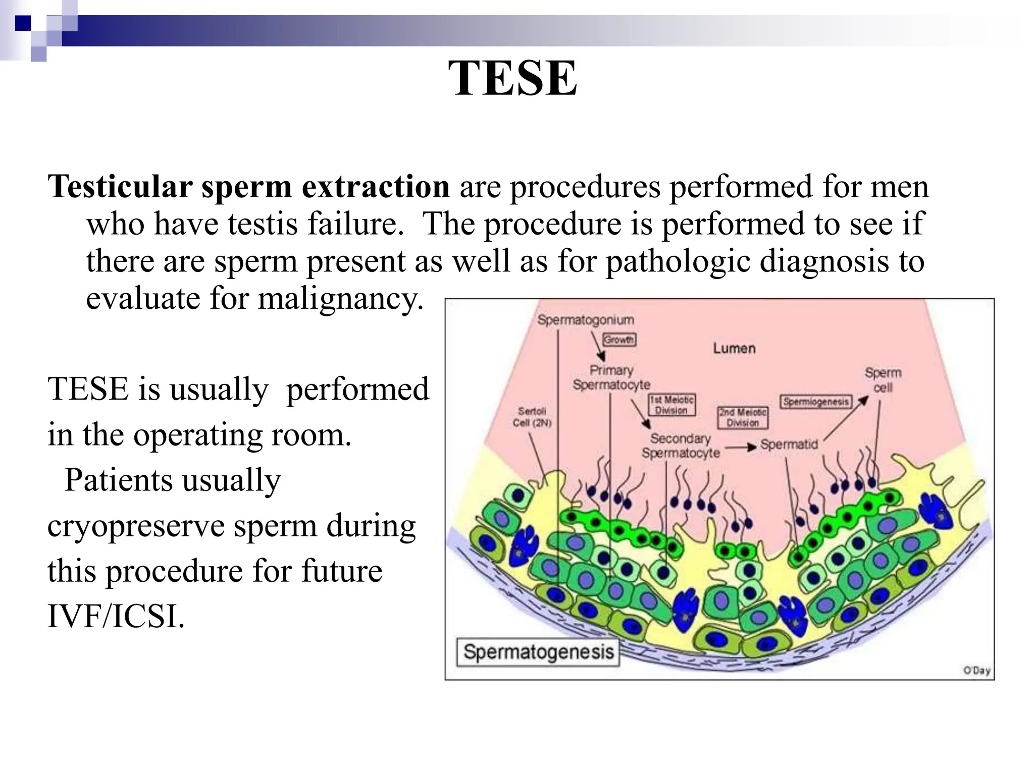 Sperm Assesmen&preparation&cryopreservation.ppt