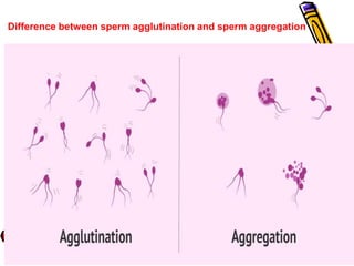 Sperm Assesmen&preparation&cryopreservation.ppt