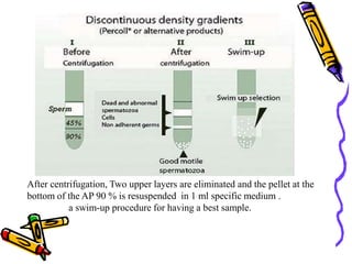 Sperm Assesmen&preparation&cryopreservation.ppt