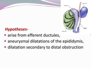 Spermatocoele | PPTX
