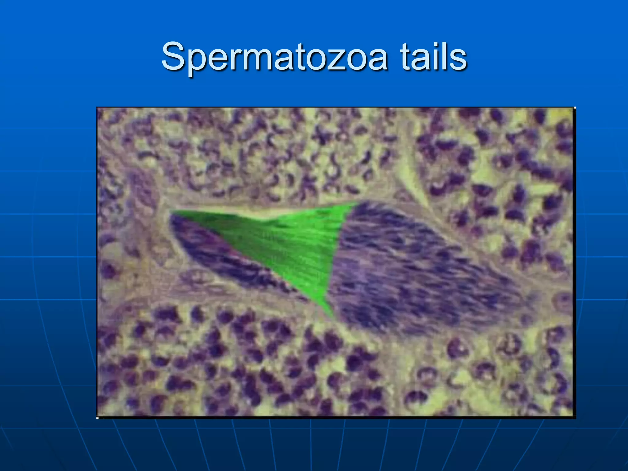 Spermatogenesis fish 07 | PPT