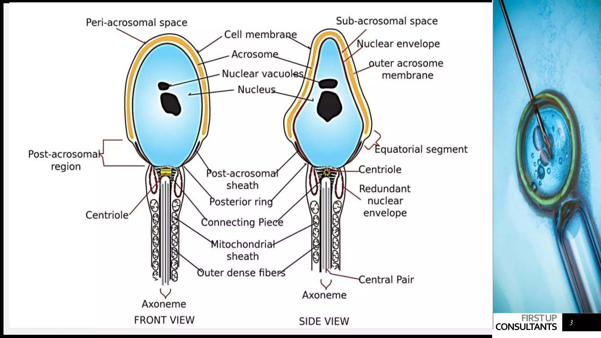 Spermatorrhea - medical information & medical aspects | PPT