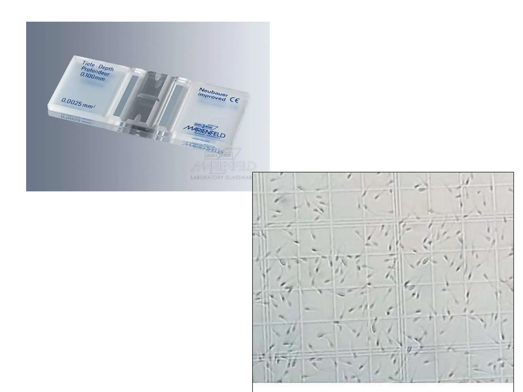 Rapid Test for Semen Analysis:Sperm Count | PPTX