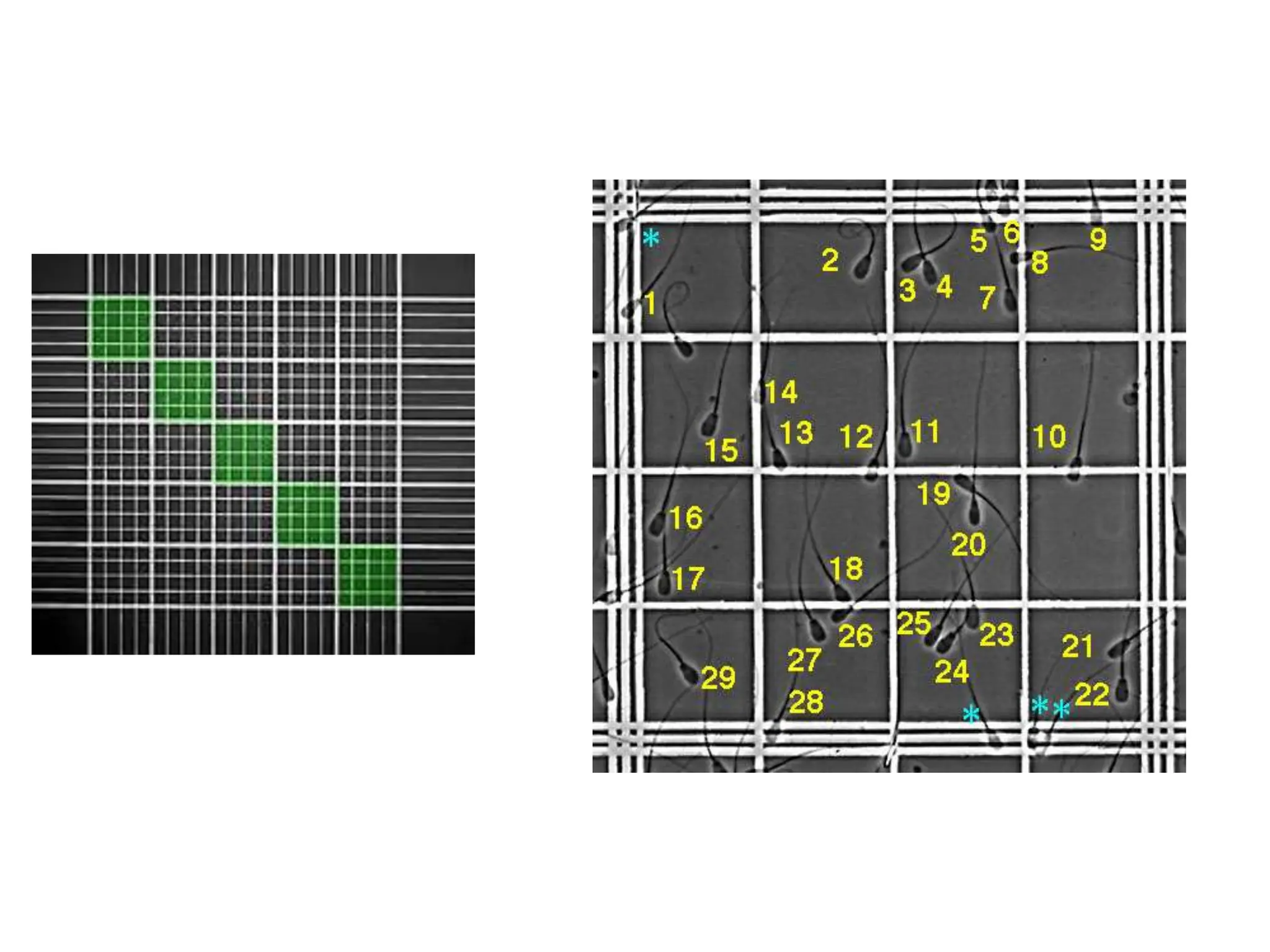 Rapid Test for Semen Analysis:Sperm Count | PPTX