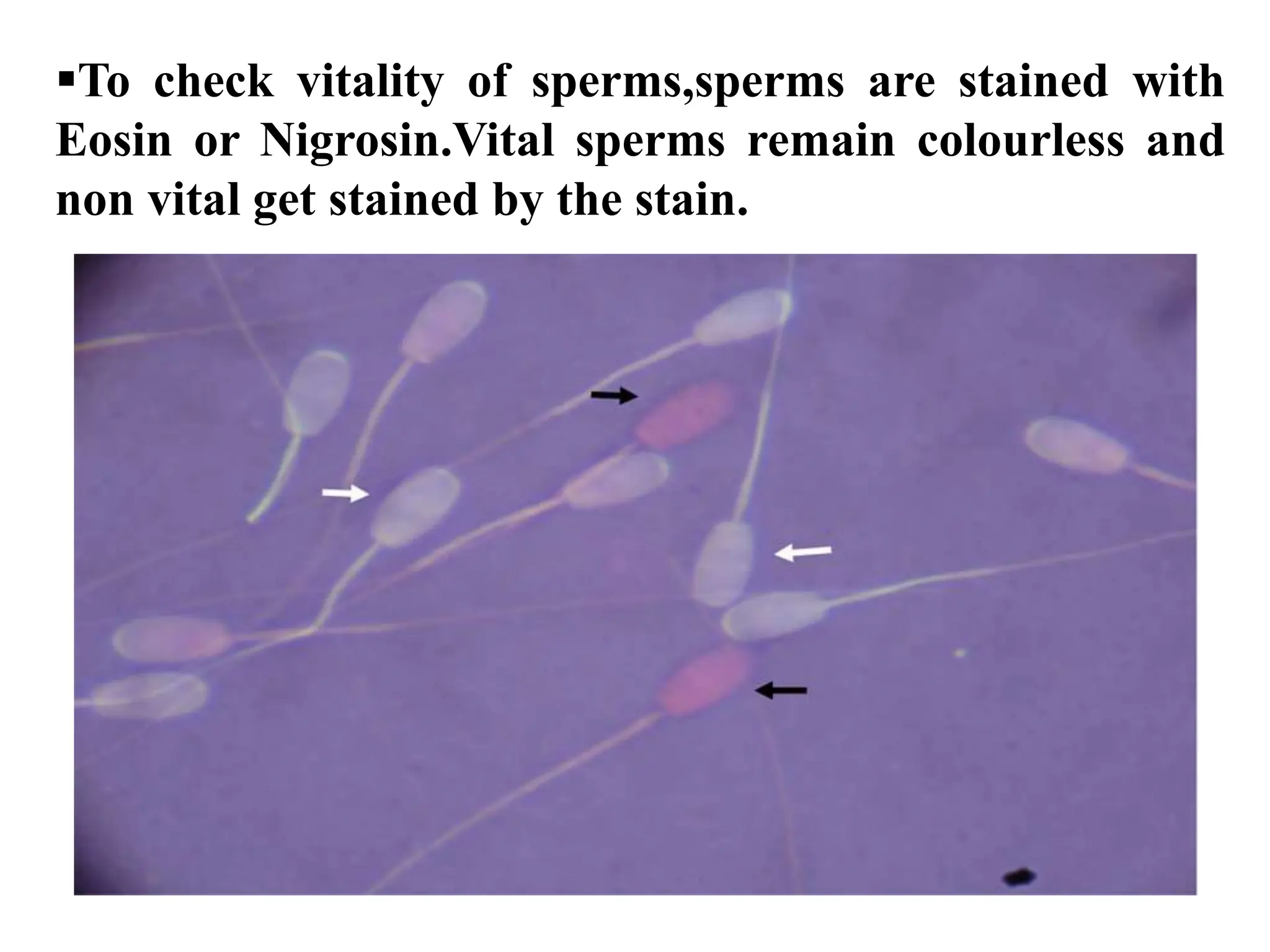 Rapid Test for Semen Analysis:Sperm Count | PPTX