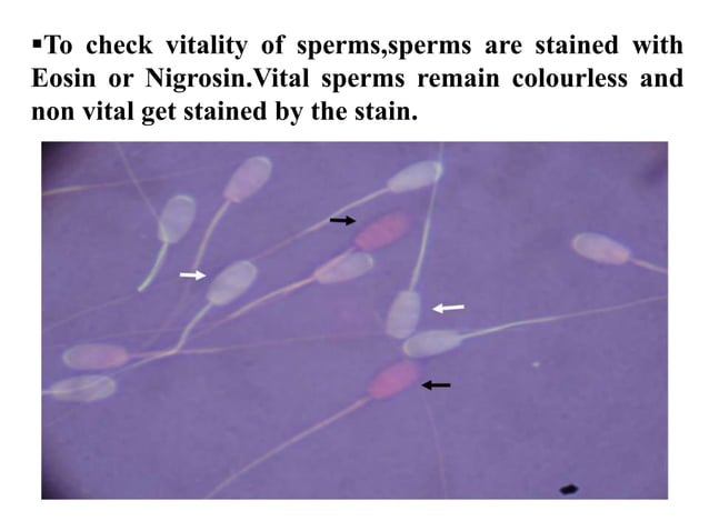 Rapid Test for Semen Analysis:Sperm Count | PPTX