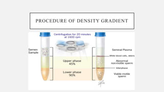 SPERM DENSITY GRADIENTS.pptx