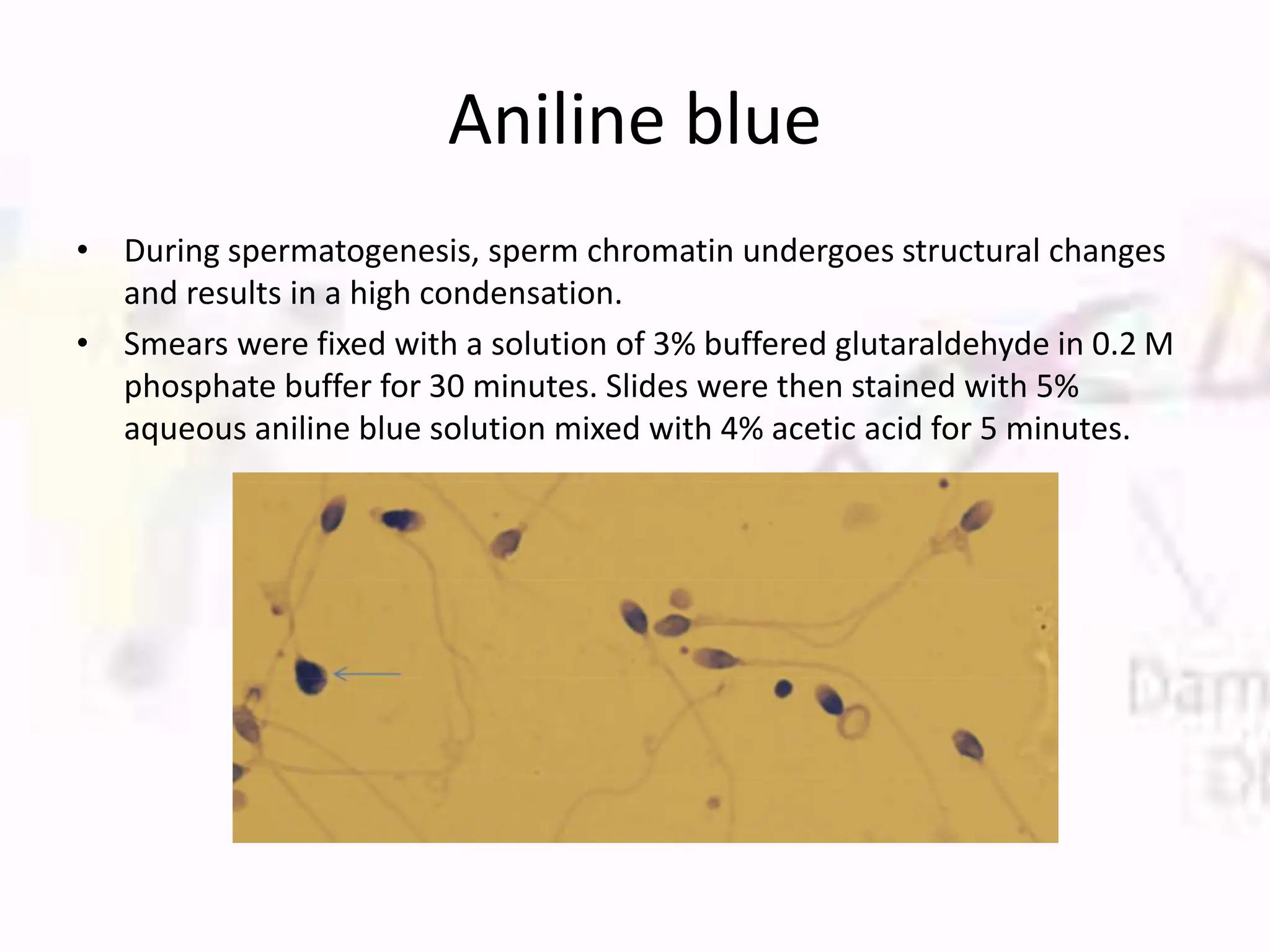 SPERM DNA DAMAGE/SPERM DNA FRAGMENTATION.pptx