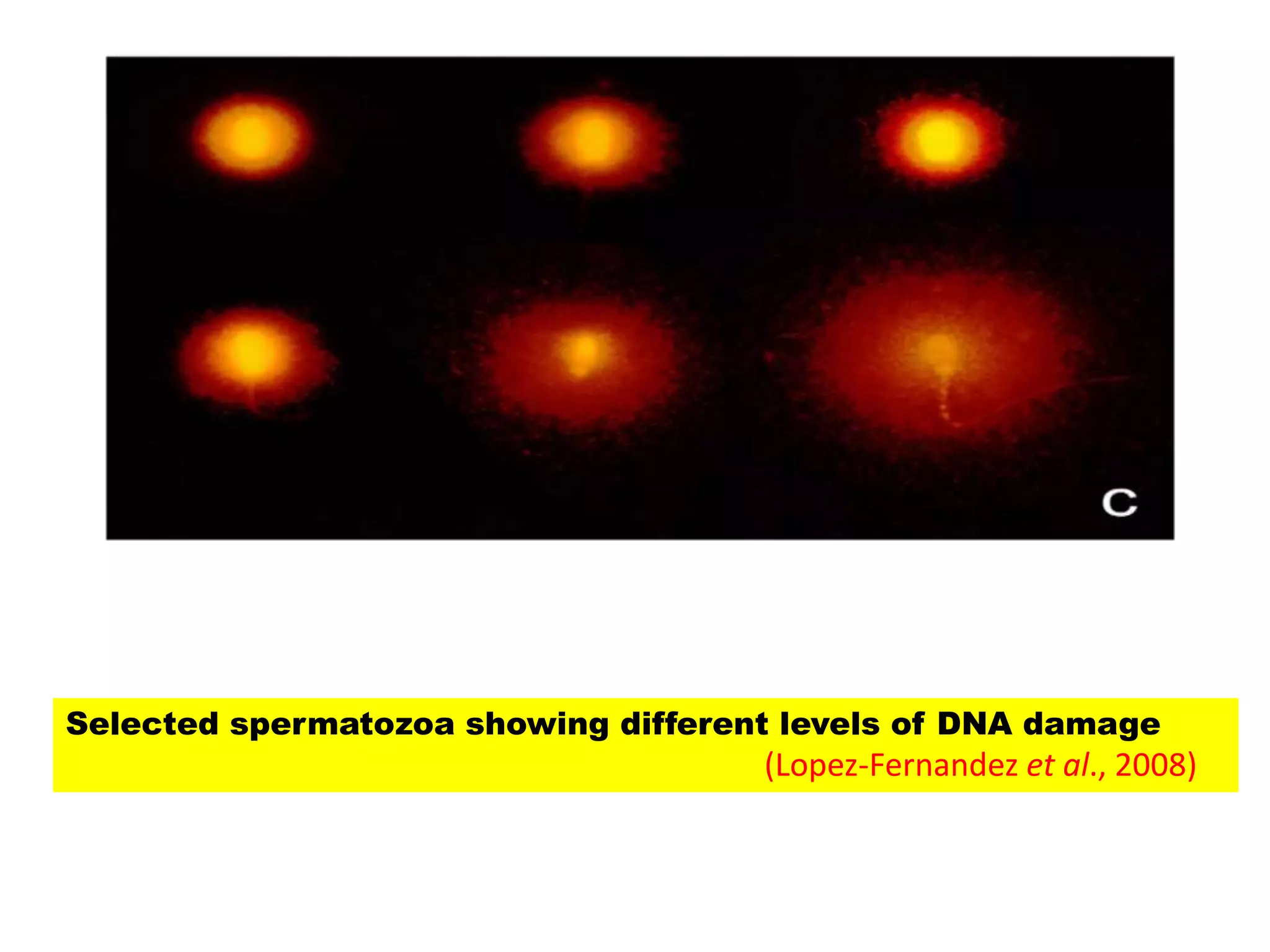 Sperm DNA fragmentation, Mechanism of origin and its effect on fertility | PPTX | Infertility ...