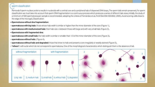 Sperm dna fragmentation | PPTX