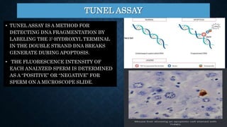 Sperm nuclear integrity assessment [autosaved] | PPT