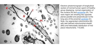spermogram, Pre-testicular factors refer to conditions that impede .pptx