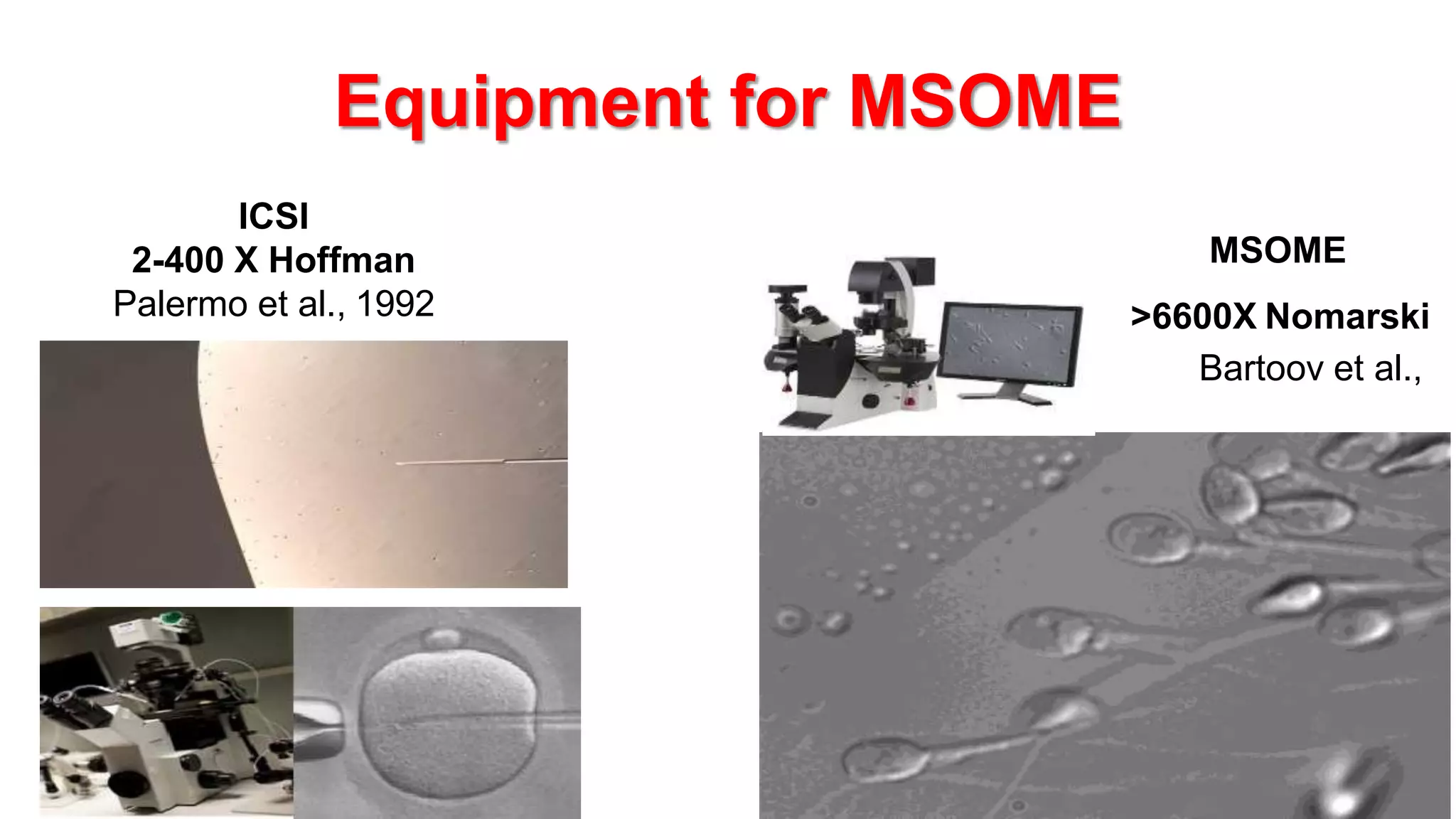Sperm Preparation in High DFI.pptx