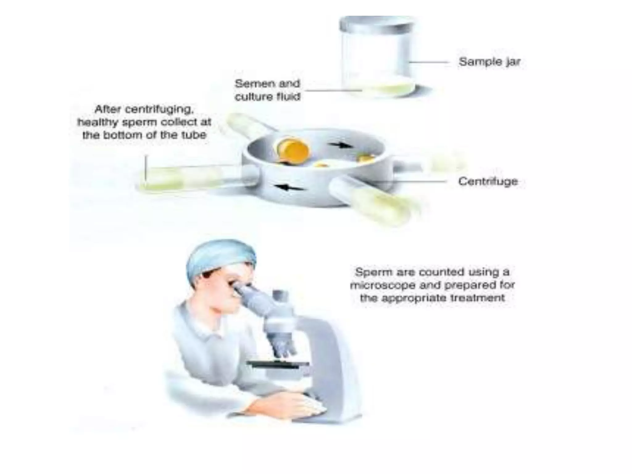 Sperm preparation techniques | PPTX