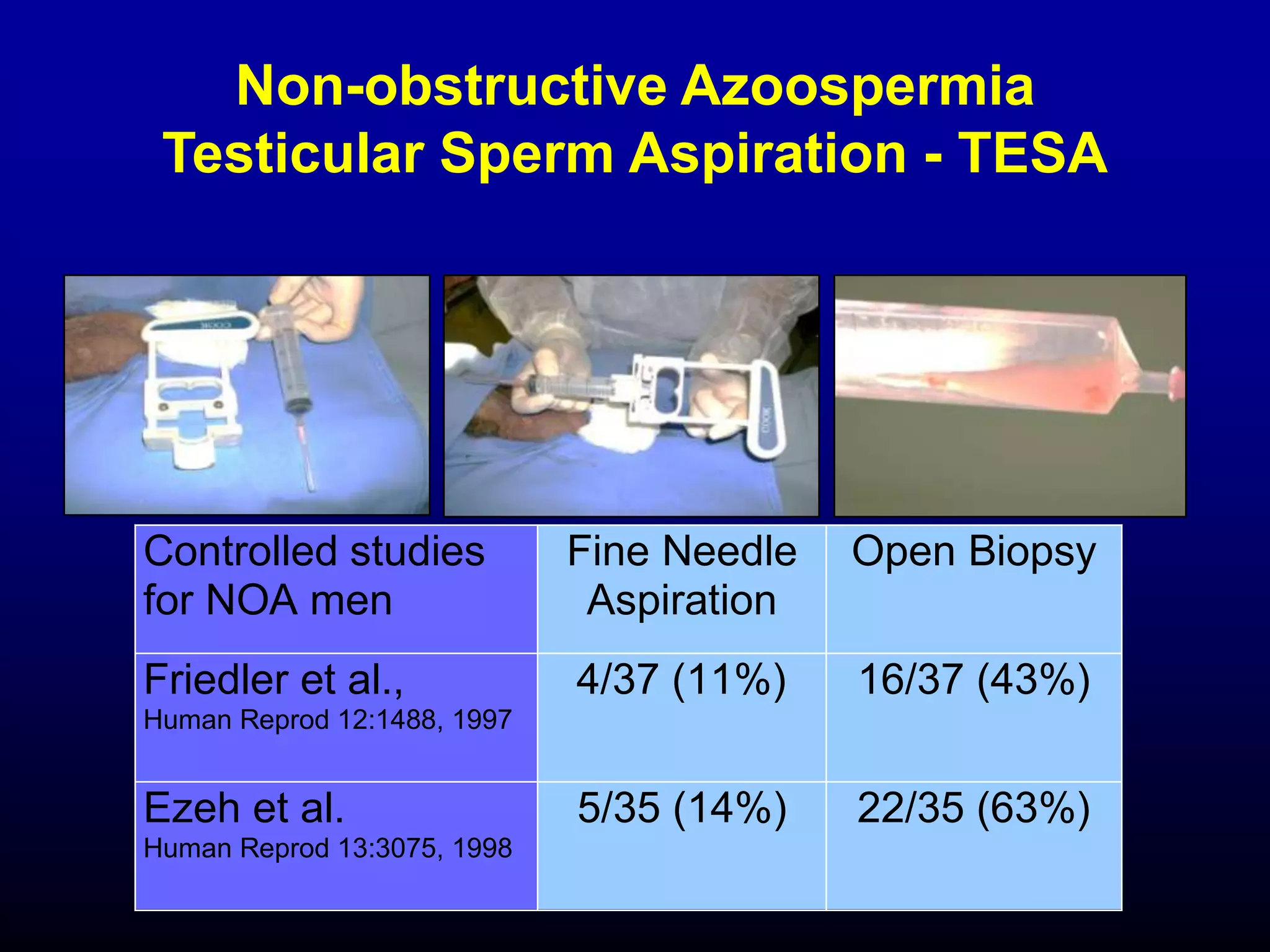 Sperm retrieval techniques | PPTX