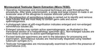 Sperm retrieval techniques | PPTX