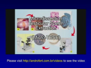 Extracting Human Semen