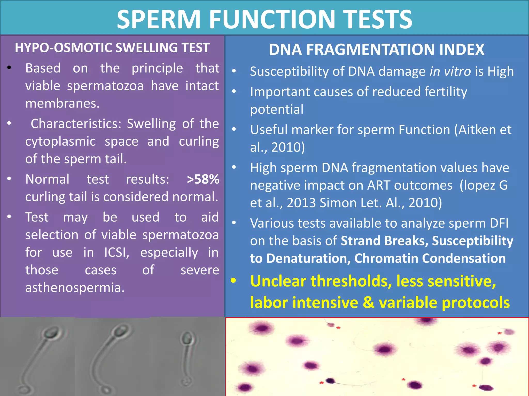 SPERM SELECTION IN ICSI | PDF