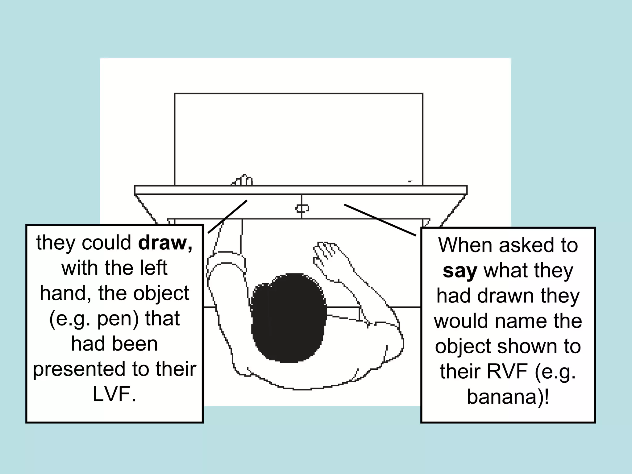Sperry (1968) split brain study | PPT