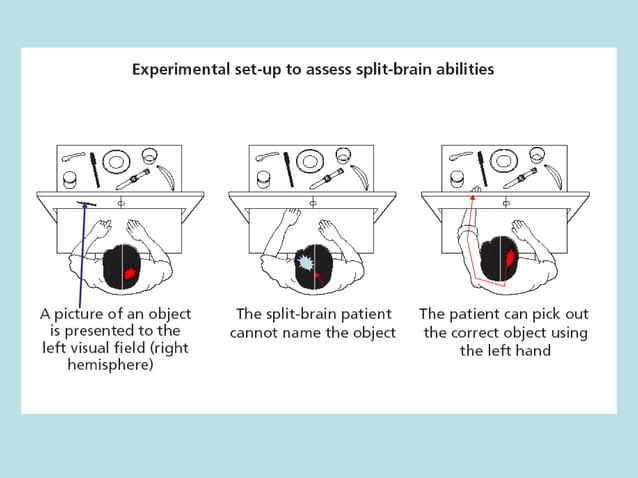 Sperry (1968) split brain study | PPT