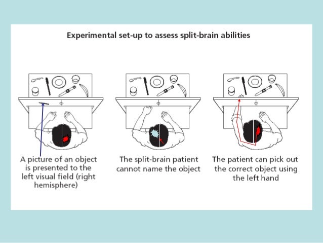 Sperry (1968) split brain study