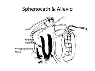 SPG Blocks lecture in Buenos Aires | PPT