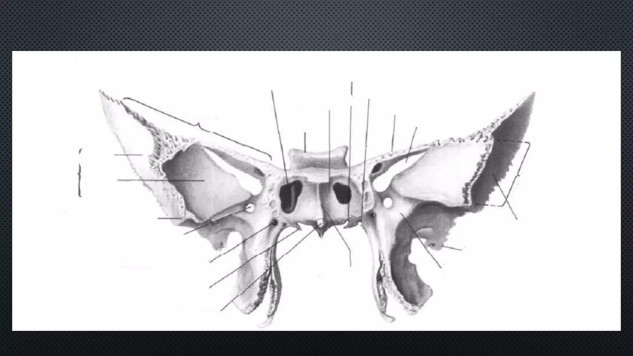 Sphenoid and Ethmoid bones | PPTX | Bone and Joint Conditions ...