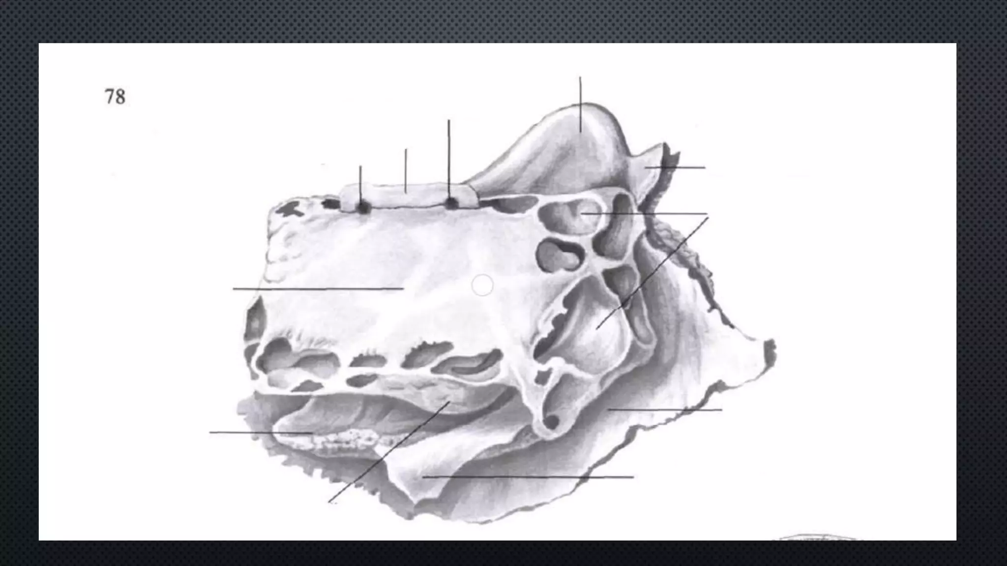 Sphenoid and Ethmoid bones | PPTX | Bone and Joint Conditions ...