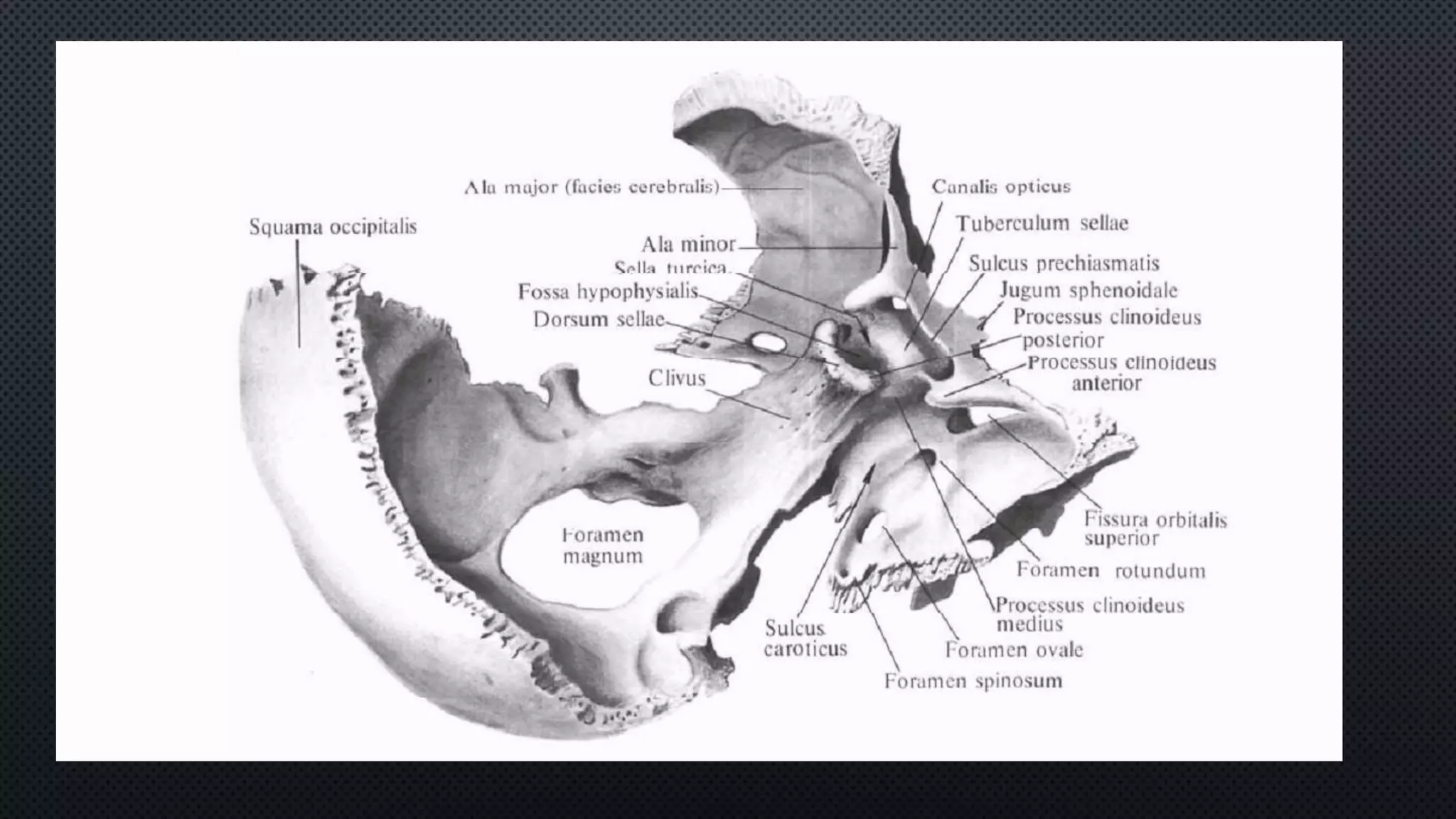 Sphenoid and Ethmoid bones | PPTX | Bone and Joint Conditions | Diseases and Conditions