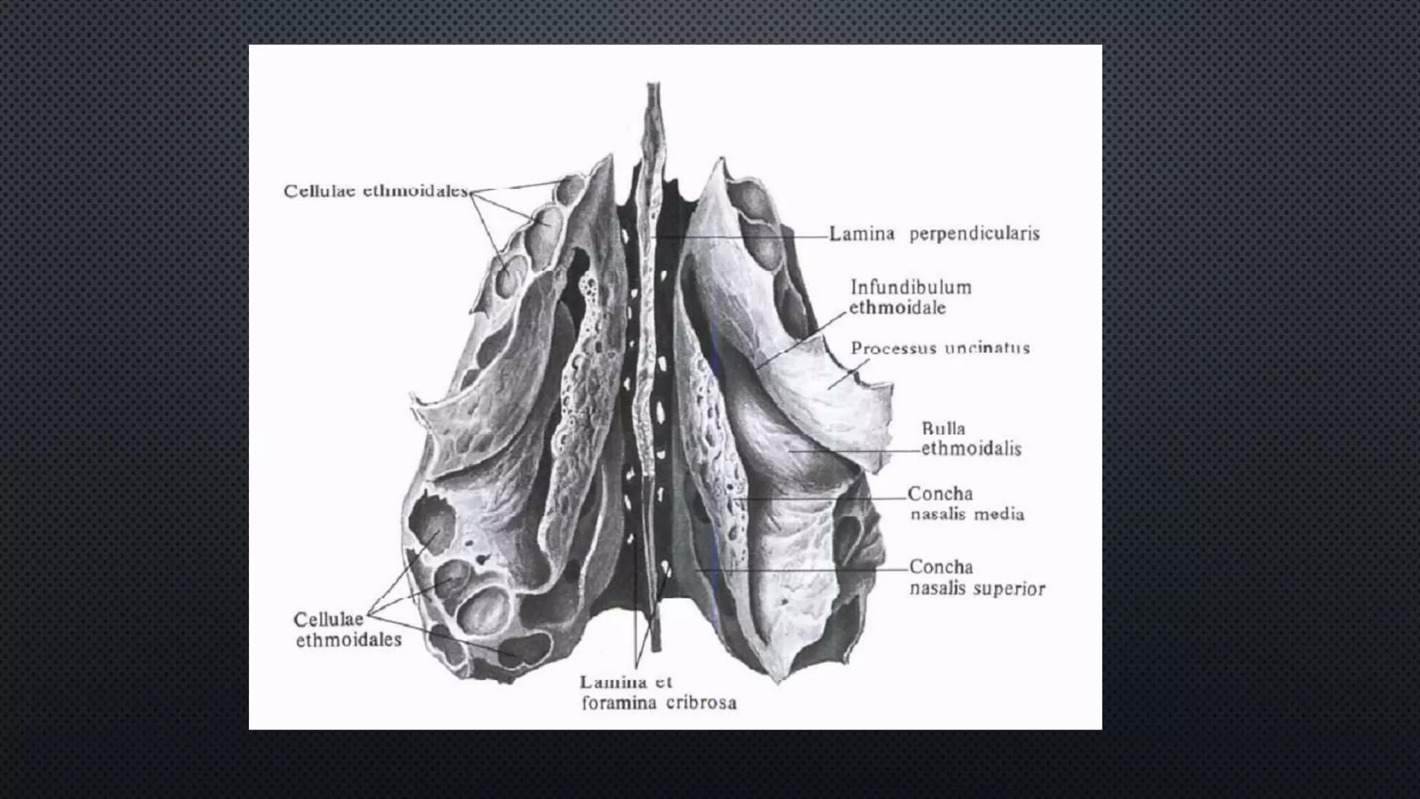 Sphenoid and Ethmoid bones | PPTX | Bone and Joint Conditions ...