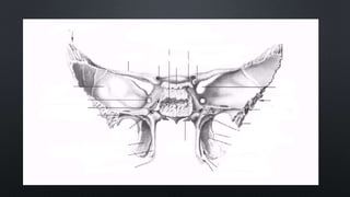 Sphenoid and Ethmoid bones | PPTX