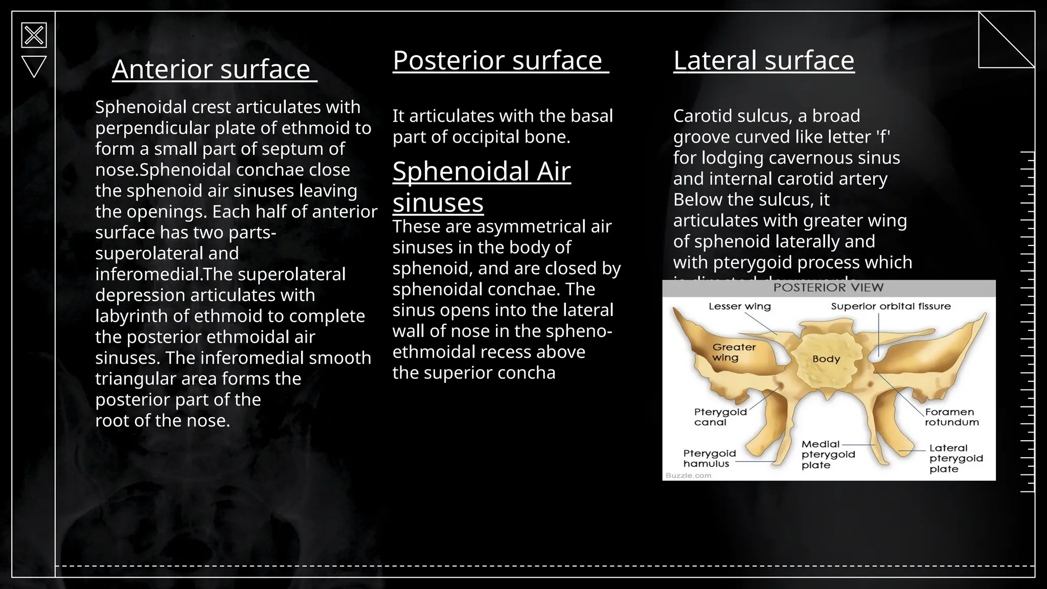 sphenoid bone anatomy and clinical anatomy | PPTX
