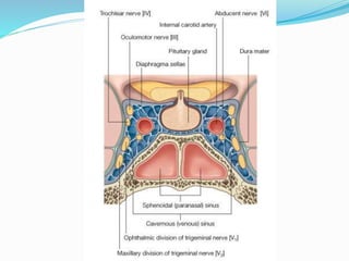 Sphenoid sinus and optic nerve | PPTX