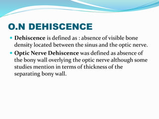 Sphenoid sinus and optic nerve | PPTX