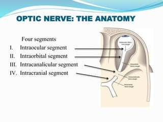 Optic Nerve And Sphenoid