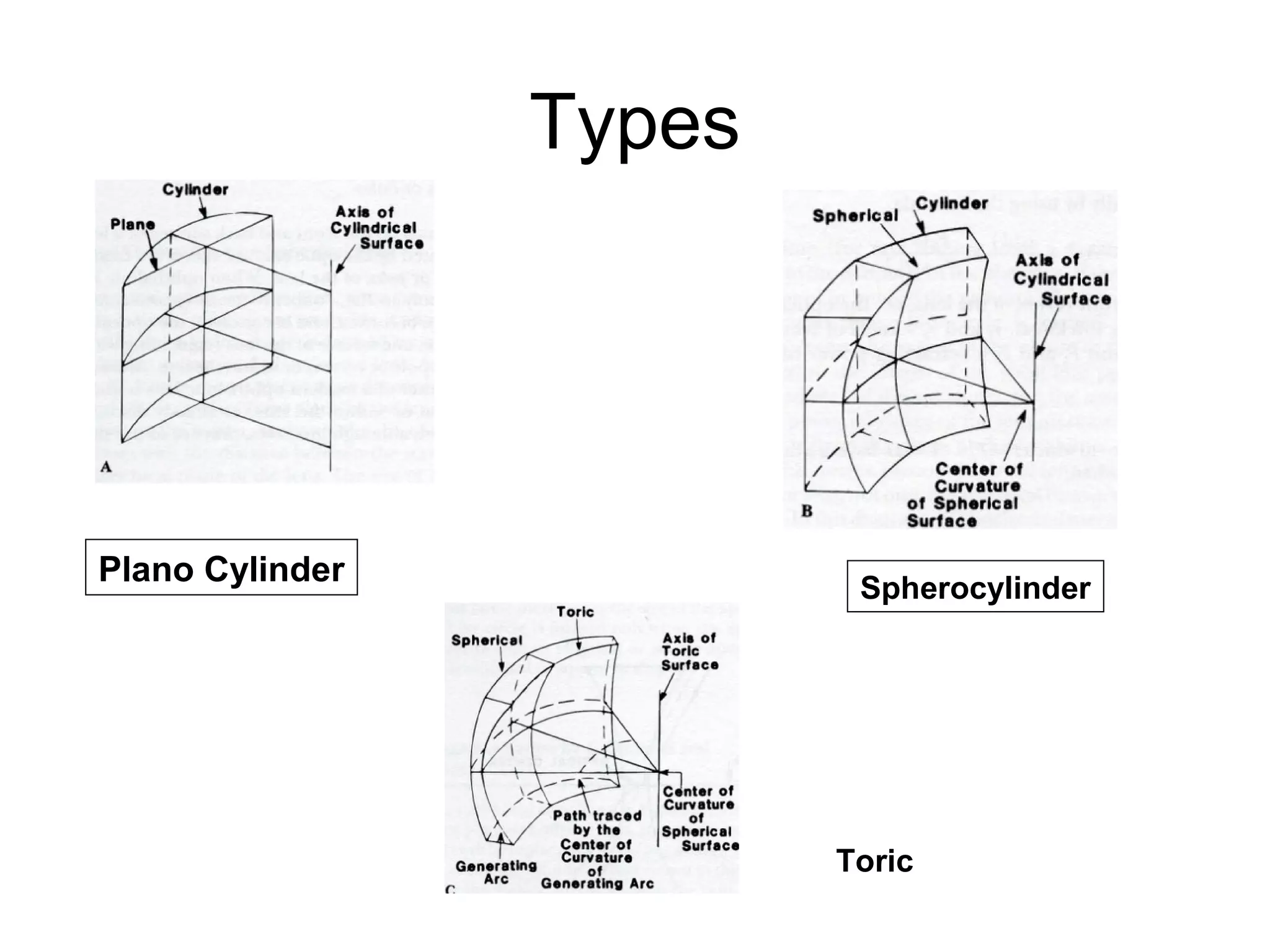 Spherical, cylindrical and toric lenses | PPT