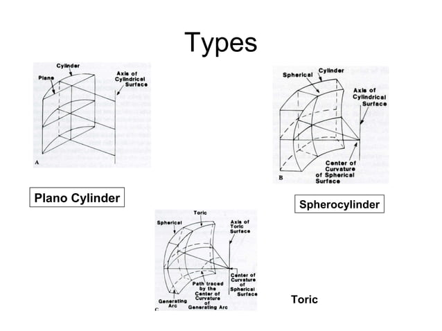 Spherical, cylindrical and toric lenses | PPT | Eye and Vision ...