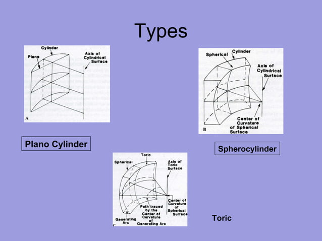 Beginner’s Guide: Spherical & Cylindrical Lenses | PPT | Eye and Vision ...
