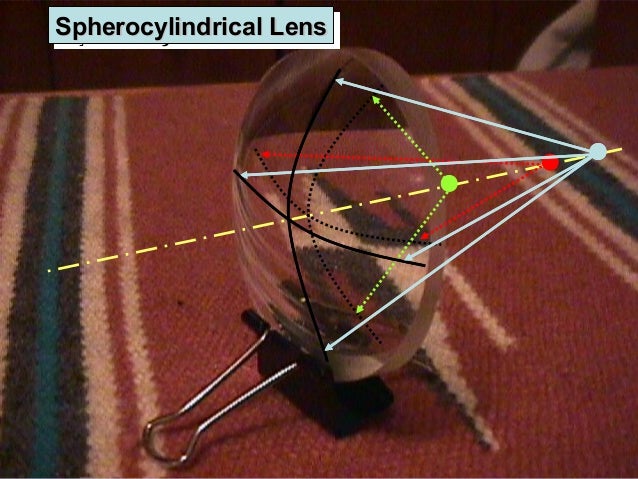 Beginner’s Guide: Spherical & Cylindrical Lenses