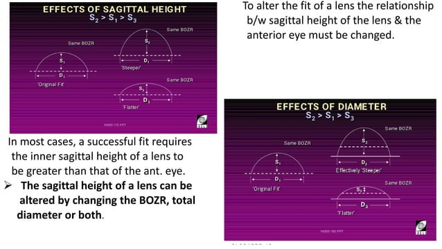 Spherical soft contact lens fitting | PPTX
