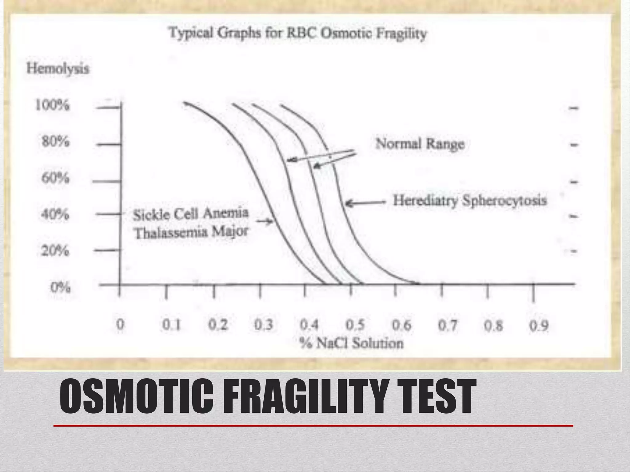 Spherocytes significance and differential diagnosis | PPTX