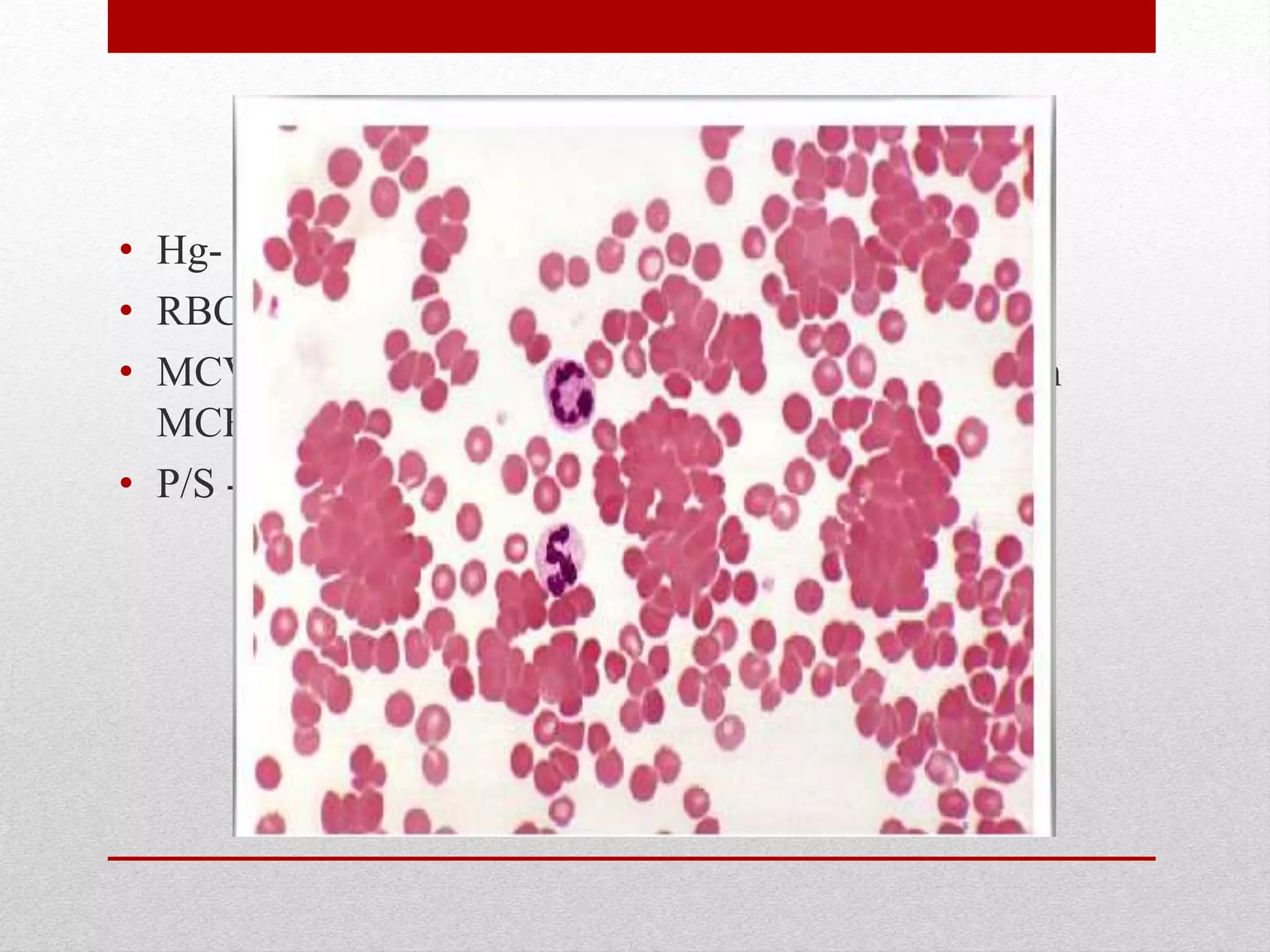 Spherocytes significance and differential diagnosis | PPTX