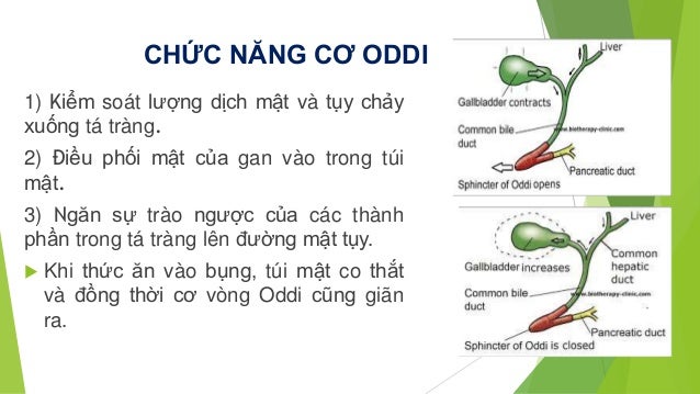 Rối loạn chức năng cơ vòng Oddi (Sphincter of oddi dysfunction)
