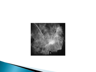 Spiculate breast mass | PPTX