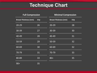 Digital Breast Tomosynthesis with Minimal Compression | PPTX | Medical ...