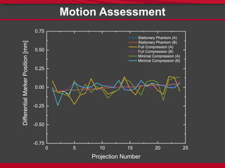 Digital Breast Tomosynthesis with Minimal Compression | PPTX | Medical ...