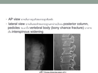 Spinal Fx | PPTX