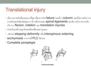 Spinal Fx | PPT